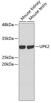 Uroplakin 2 Antibodies | AntibodyResource.com