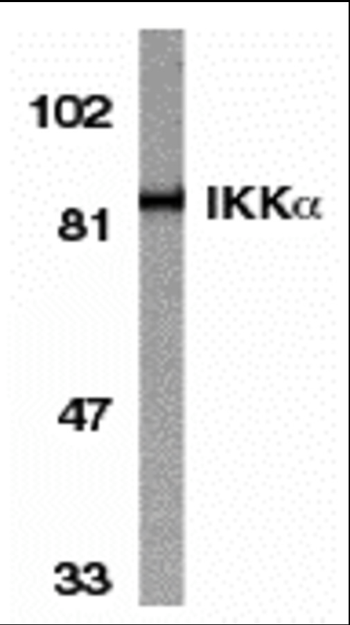 IKK alpha/beta Antibodies | AntibodyResource.com
