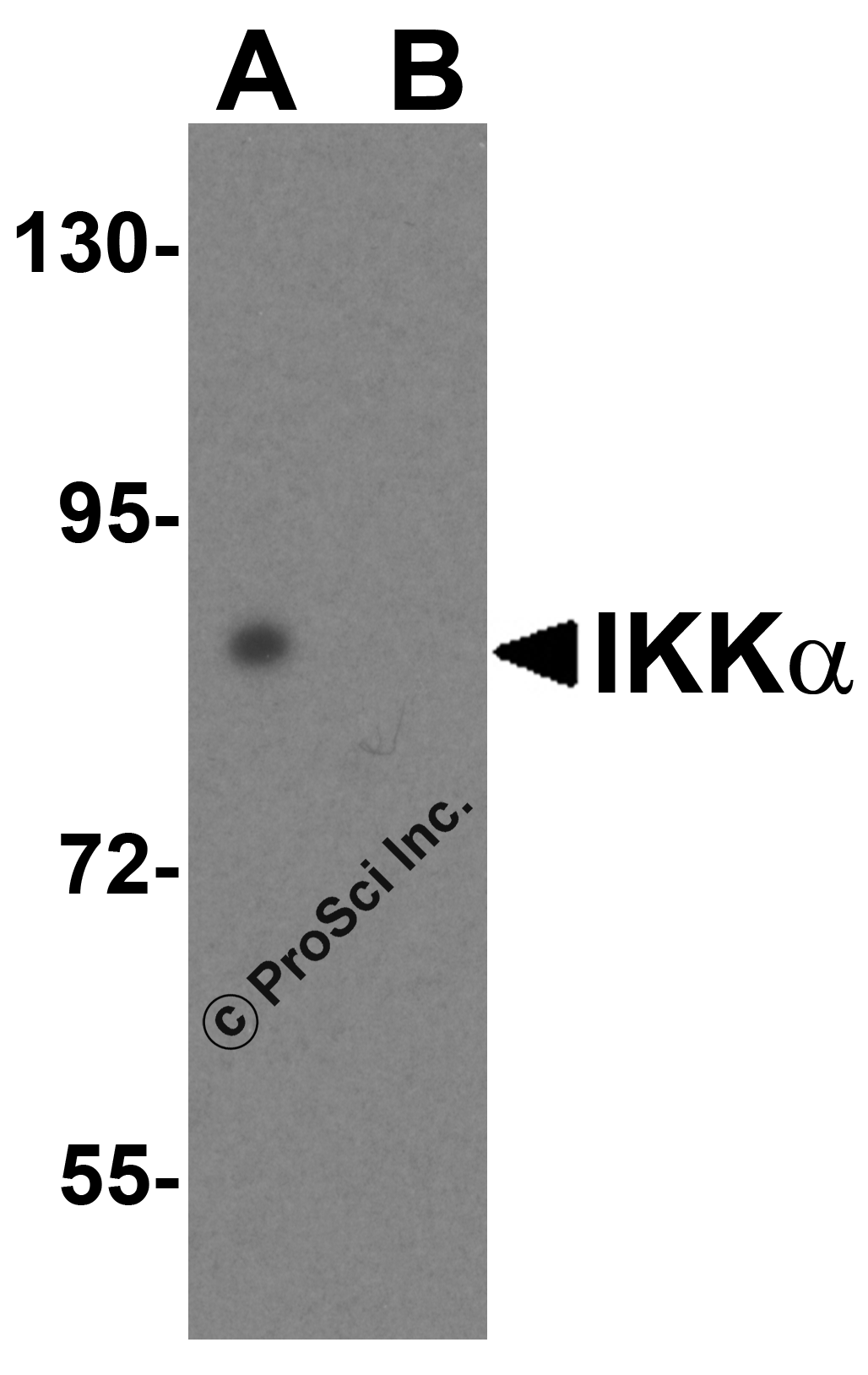IKK alpha/beta Antibodies | AntibodyResource.com
