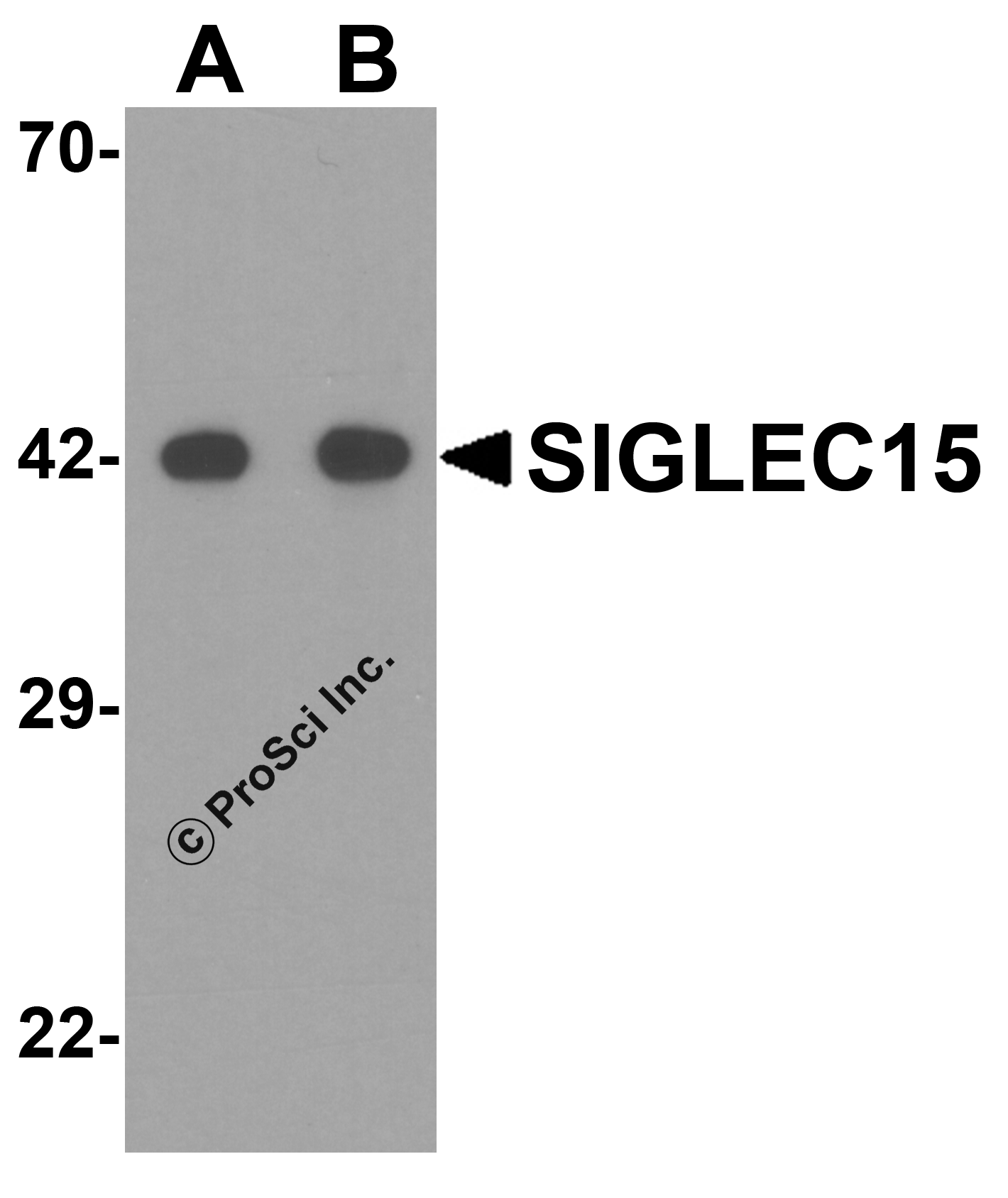 Siglec-15 Antibodies | AntibodyResource.com