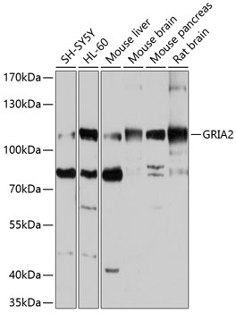GRIA2 Antibody - Cat. No. 13-036 | ProSci