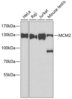 MCM2 Antibody - Cat. No. 13-187 | ProSci