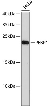 PEBP1 Antibody - Cat. No. 13-207 | ProSci