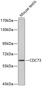 CDC73 Antibody - Cat. No. 13-230 | ProSci