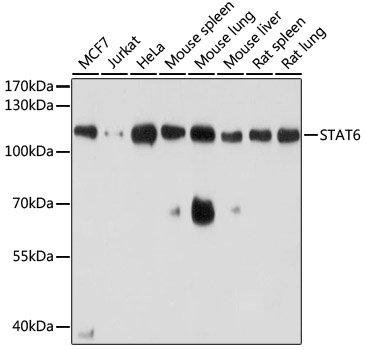 STAT6 Antibody - Cat. No. 13-275 | ProSci