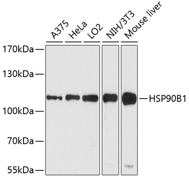 HSP90B1 Antibody - Cat. No. 13-356 | ProSci