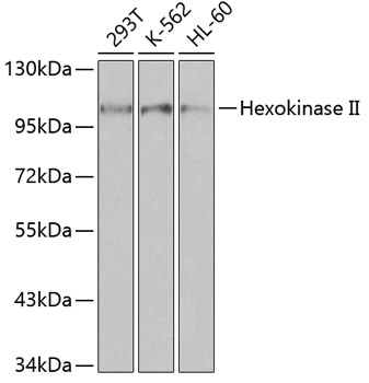 Hexokinase II Antibody - Cat. No. 13-360 | ProSci