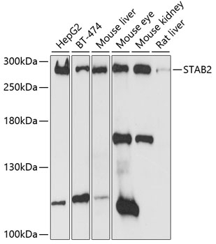 STAB2 Antibody - Cat. No. 13-413 | ProSci
