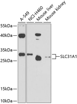 SLC31A1 Antibody - Cat. No. 13-433 | ProSci