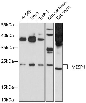 MESP1 Antibody - Cat. No. 13-461 | ProSci