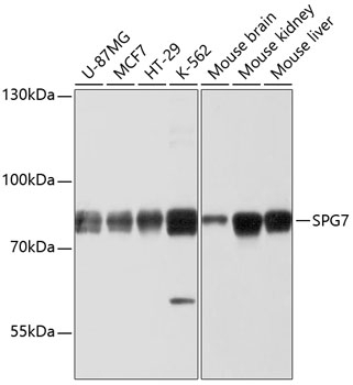 SPG7 Antibody - Cat. No. 13-530 | ProSci