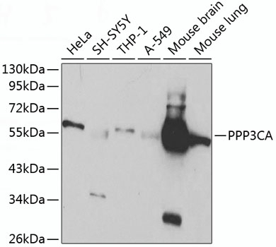PPP3CA Antibody - Cat. No. 13-765 | ProSci