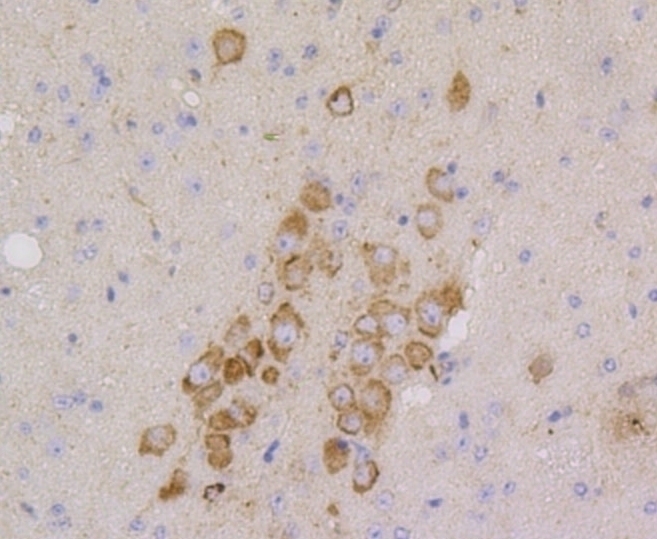 CD9 Antibody [4F10B5] - Cat. No. 13-804 | ProSci