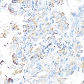 SDHB Antibody - Cat. No. 13-817 | ProSci