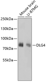 DLG4 Antibody [D5E5] - Cat. No. 13-831 | ProSci