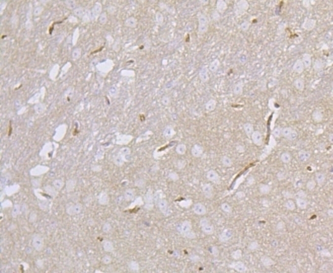 DLG4 Antibody [D5E5] - Cat. No. 13-831 | ProSci