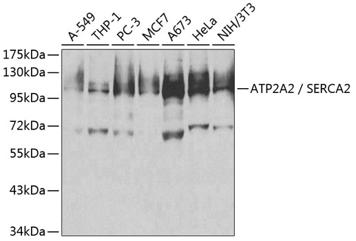 ATP2A2 / SERCA2 Antibody - Cat. No. 13-873 | ProSci