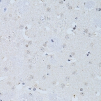 POLR2A Antibody - Cat. No. 13-946 | ProSci