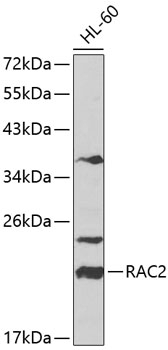 RAC2 Antibody - Cat. No. 14-009 | ProSci