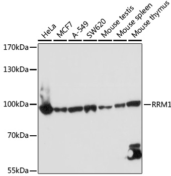 RRM1 Antibody - Cat. No. 14-040 | ProSci