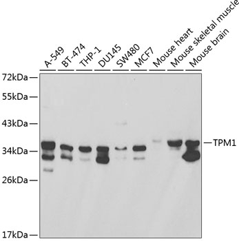 TPM1 Antibody - Cat. No. 14-051 | ProSci