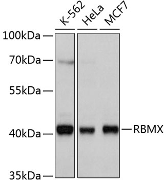 RBMX Antibody - Cat. No. 14-159 | ProSci