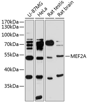 MEF2A Antibody - Cat. No. 14-241 | ProSci