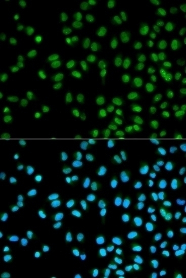 CST8 Antibody - Cat. No. 14-329 | ProSci