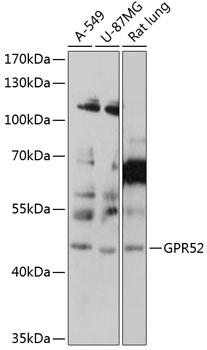 GPR52 Antibody - Cat. No. 14-348 | ProSci