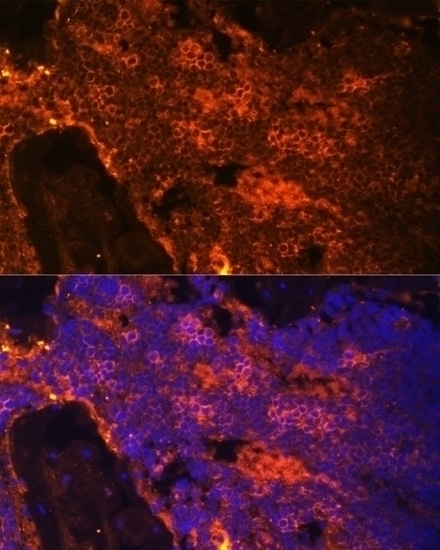 SPTA1 Antibody - Cat. No. 14-375 | ProSci