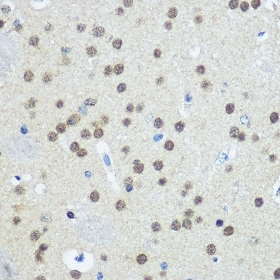 UBA1 Antibody - Cat. No. 14-377 | ProSci