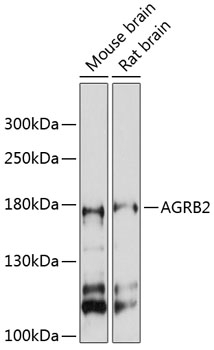 AGRB2 Antibody - Cat. No. 14-386 | ProSci