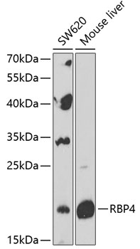RBP4 Antibody - Cat. No. 14-460 | ProSci