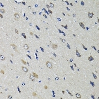 RBP4 Antibody - Cat. No. 14-460 | ProSci