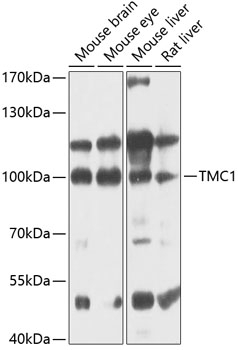 TMC1 Antibody - Cat. No. 14-539 | ProSci