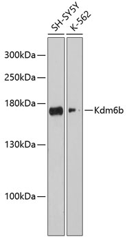 Kdm6b Antibody - Cat. No. 14-618 | ProSci