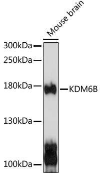 Kdm6b Antibody - Cat. No. 14-618 | ProSci
