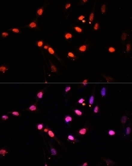 Kdm6b Antibody - Cat. No. 14-618 | ProSci