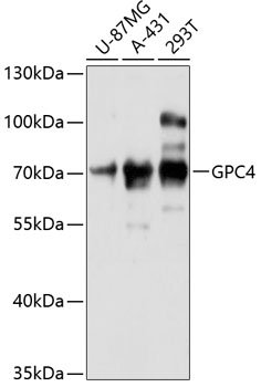 GPC4 Antibody - Cat. No. 14-635 | ProSci