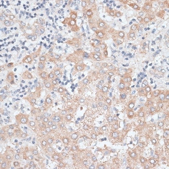 GPC4 Antibody - Cat. No. 14-635 | ProSci