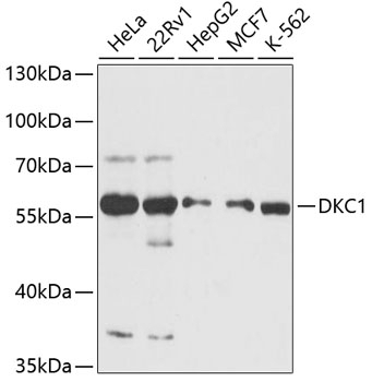DKC1 Antibody - Cat. No. 14-697 | ProSci