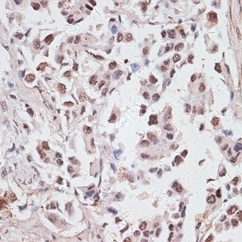 DKC1 Antibody - Cat. No. 14-697 | ProSci