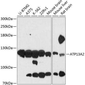 ATP13A2 Antibody - Cat. No. 14-785 | ProSci