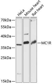 MC1R Antibody - Cat. No. 14-821 | ProSci