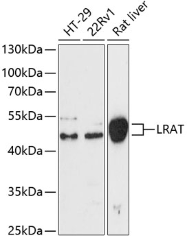 LRAT Antibody - Cat. No. 14-835 | ProSci
