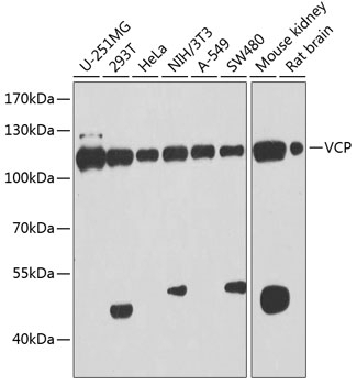 VCP Antibody - Cat. No. 14-951 | ProSci