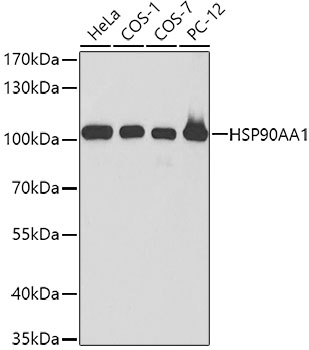 HSP90AA1 Antibody - Cat. No. 15-028 | ProSci