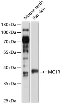 MC1R Antibody - Cat. No. 15-034 | ProSci