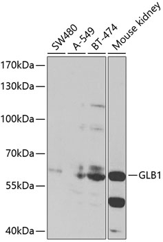 GLB1 Antibody - Cat. No. 15-136 | ProSci