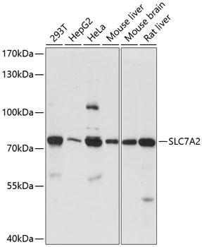SLC7A2 Antibody - Cat. No. 15-611 | ProSci